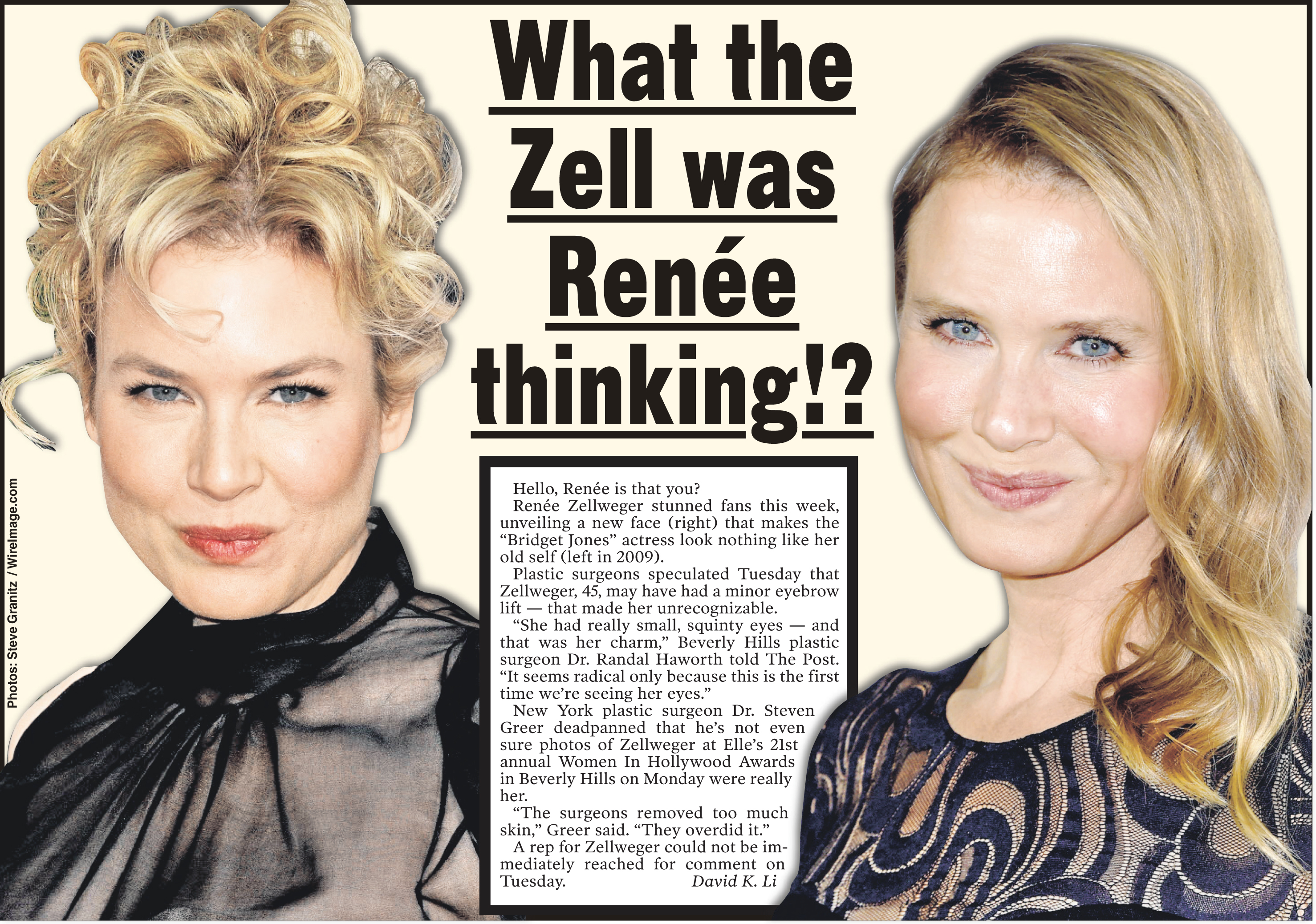 NY Post quotes the great plastic surgeon Steven E Greer, MD | The Greer ...